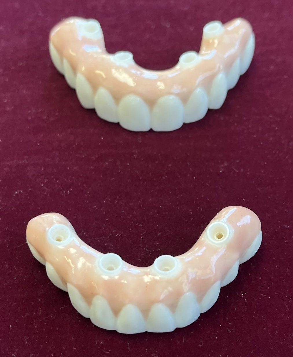 Best Dental Lab for All-on-4 Implants | Hitec Fremont